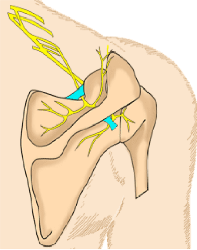 Suprascapular Nerve Impingement PhysiotherapyPhysiotherapy Suprascapular Nerve Impingement PhysiotherapyPhysiotherapy